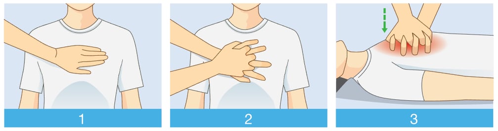 CPR Steps: How to Do CPR Safely and Effectively