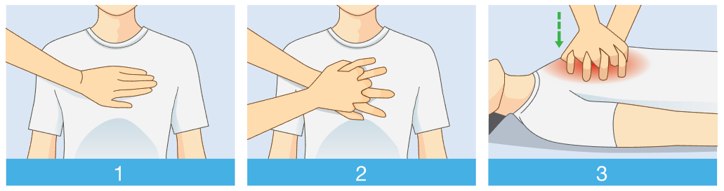 CPR Steps: How to Do CPR Safely and Effectively