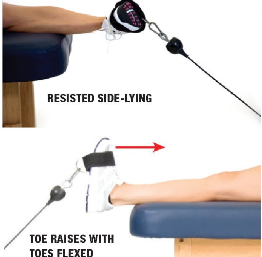 A Breakdown of Pronation Distortion Syndrome